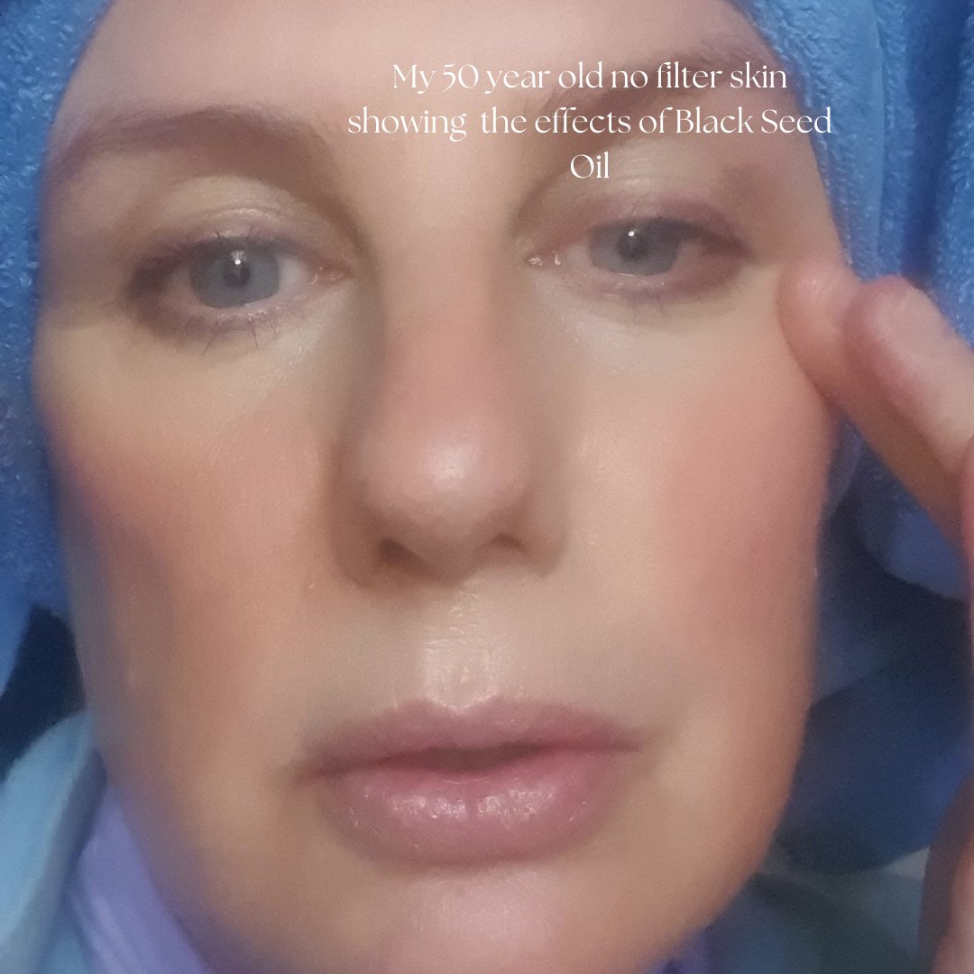 Skin Elixir: Black Seed Oil The Best Skincare Ingredient for Menopausa ...